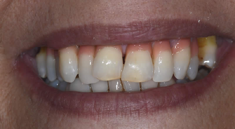Our Treatment Gallery | Ascot Dental Practice