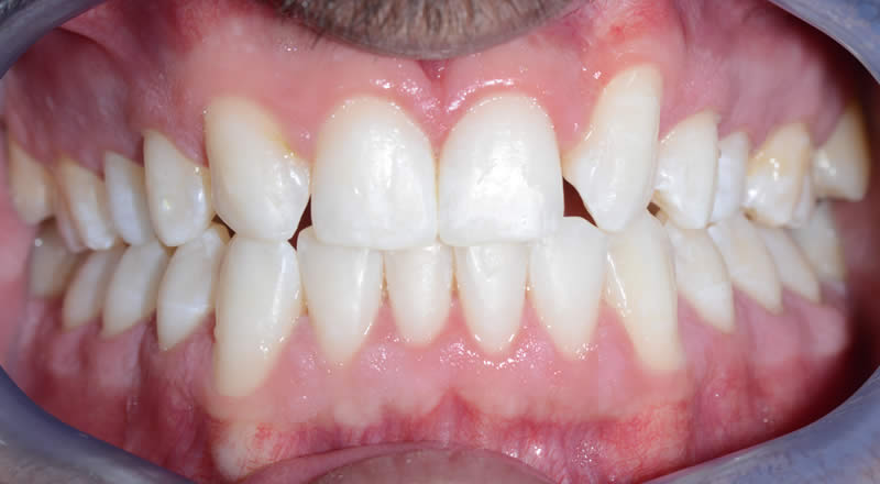 Our Treatment Gallery | Ascot Dental Practice